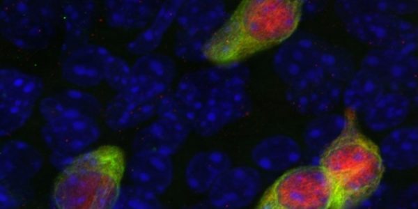 Research – Respiratory Immunology Lab